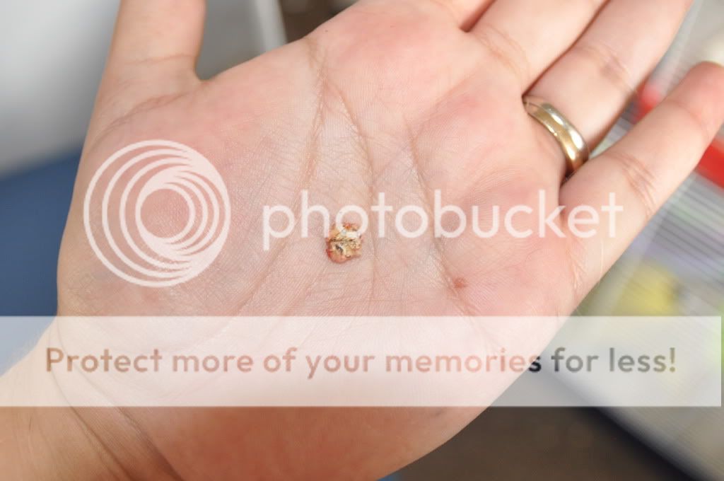 weird hole in skin - cyst? | The Rat Shack - Pet Rat Forum